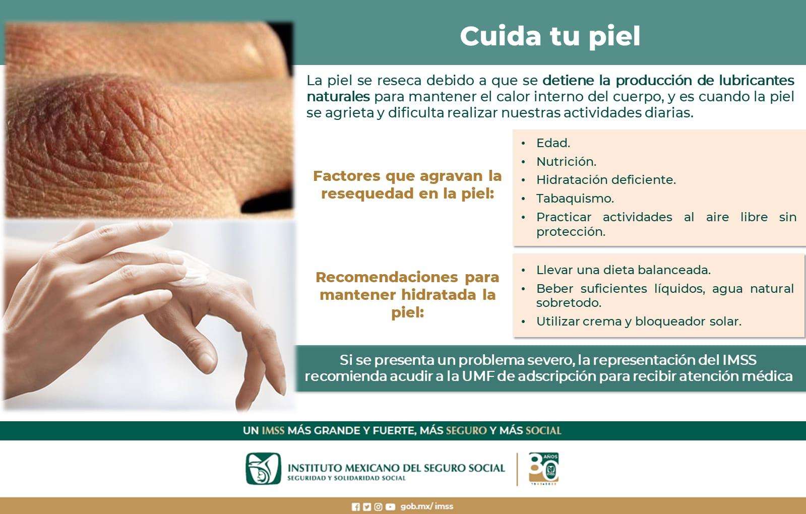 Emite Imss recomendaciones para tratar la piel reseca | El Bordo