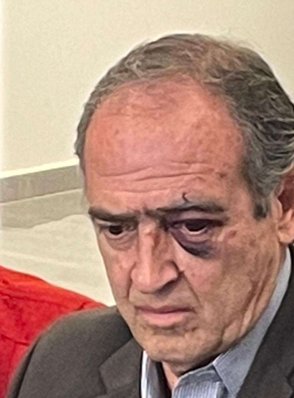 La elección interna de Canaco, motivo de la agresión a vicepresidente ...