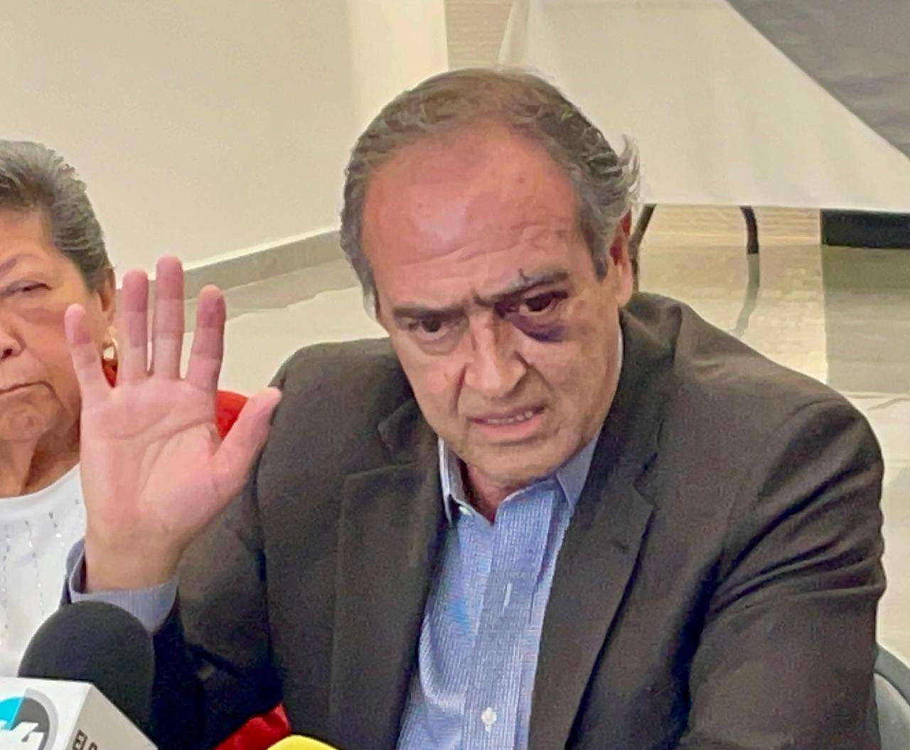 La elección interna de Canaco, motivo de la agresión a vicepresidente ...